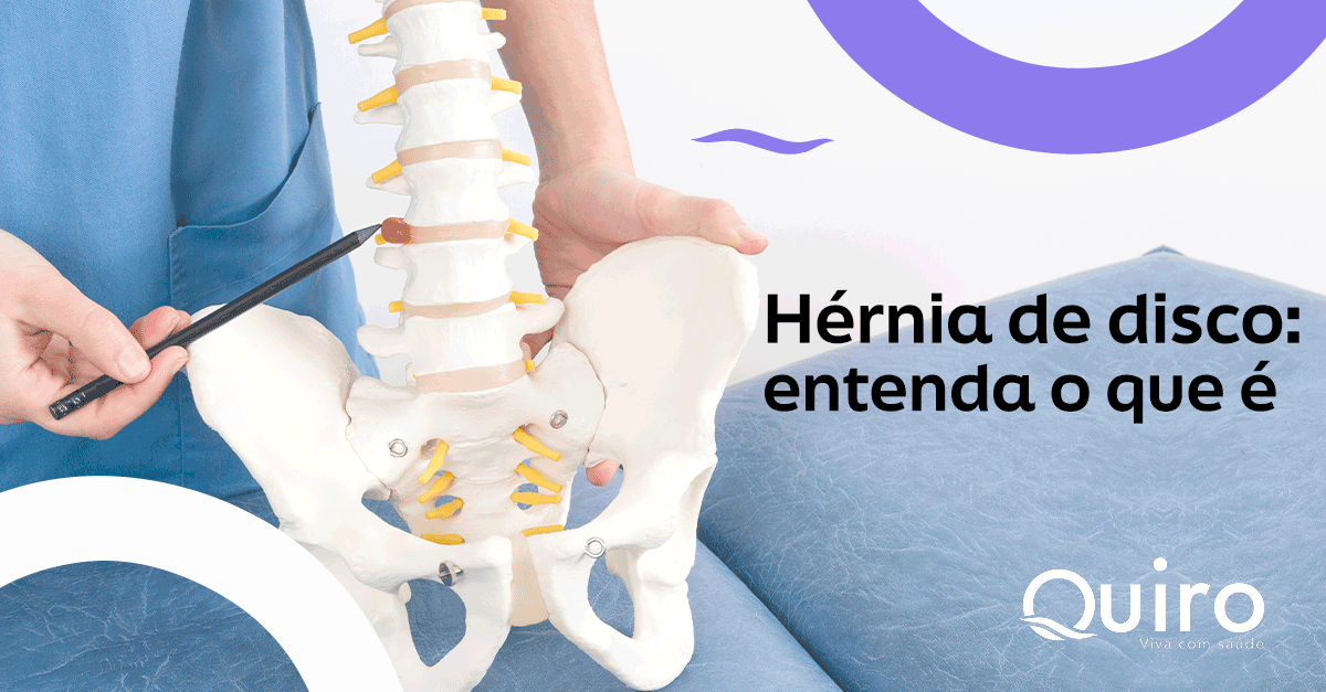 Hérnia de disco: entenda o que é – Quiro